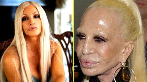 Plastic Surgery