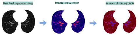 Biomedicines Free Full Text Automated Detection Of Broncho Arterial