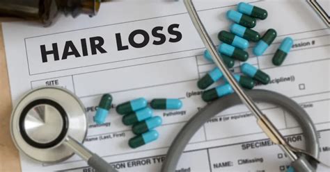 Frontal Fibrosing Alopecia Understanding The Causes And Symptoms