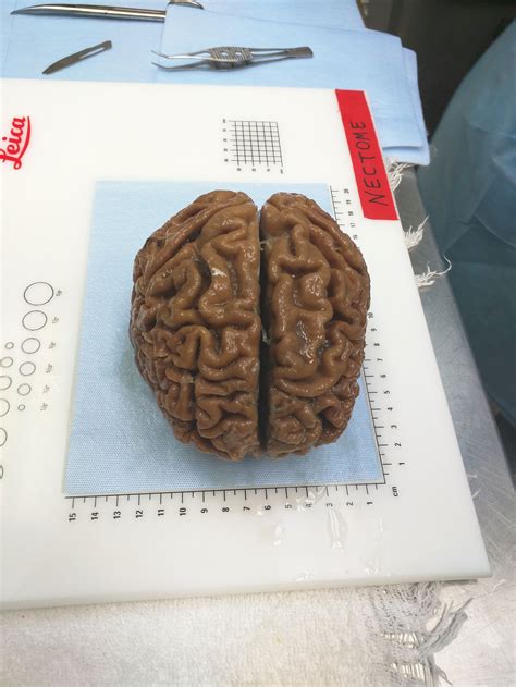 A Startup Is Pitching A Mind Uploading Service That Is 100 Percent