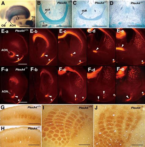 Expression Of Plexin A4 In The Forebrain And Defects In The Anterior Download Scientific