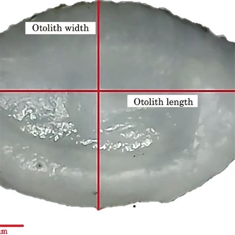 Description Of The Internal Face Of The Right Sagittal Otolith Of The Download Scientific