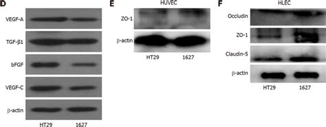 Effect Of Braf V600e Mutant Colorectal Cancer Cell Derived Exosomes On