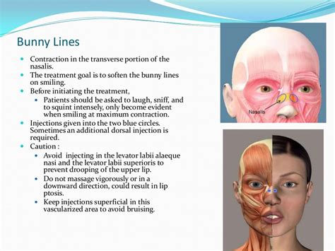Botulinum Toxin In Dermatology Ppt