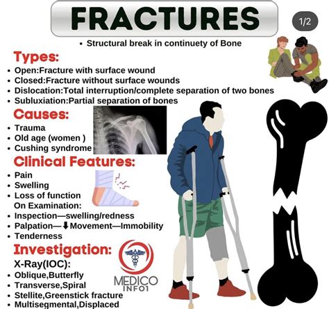 What Is Third Spacing And What Are You Going To Do About It Artofit