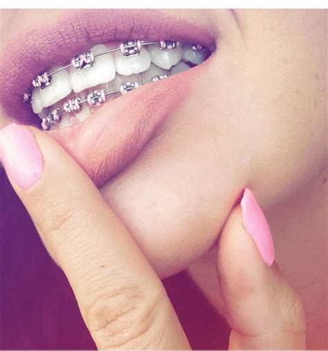 Colores De Brackets Bonitos Crawling With Blogs Photography