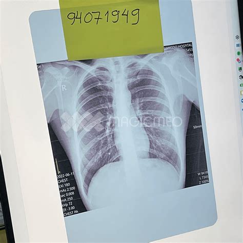 Рентген зургийн хальс Мэйжик Мед