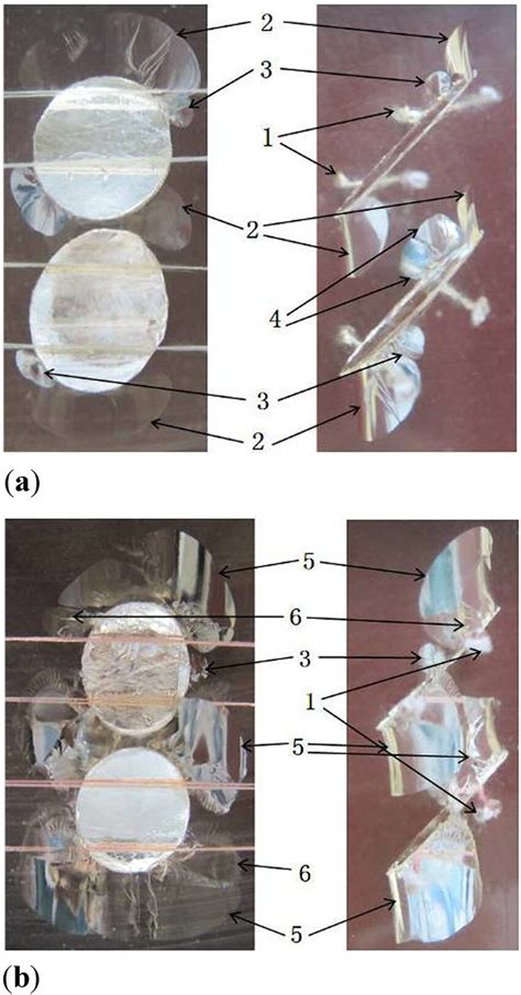 Front And Lateral Views During The Fracture Evolution Case 2 1 Download Scientific Diagram
