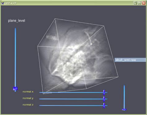 Direct Volume Rendering Dvr W Feng