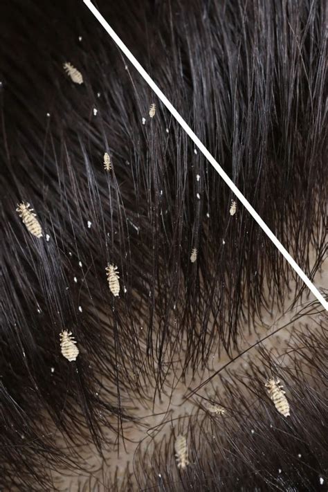 Just A Few Garlic Cloves Say Goodbye To Pests Like Mice Flies Lice