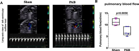 Validation Of Neonatal Pulmonary Hypoperfusion In Pab Rats At Postnatal