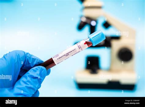 Assesses Crp Levels A Marker Of Inflammation Important For Diagnosing