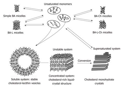 Pathophysiology Of Cholelithiasis In Flow Chart A Visual Reference Of