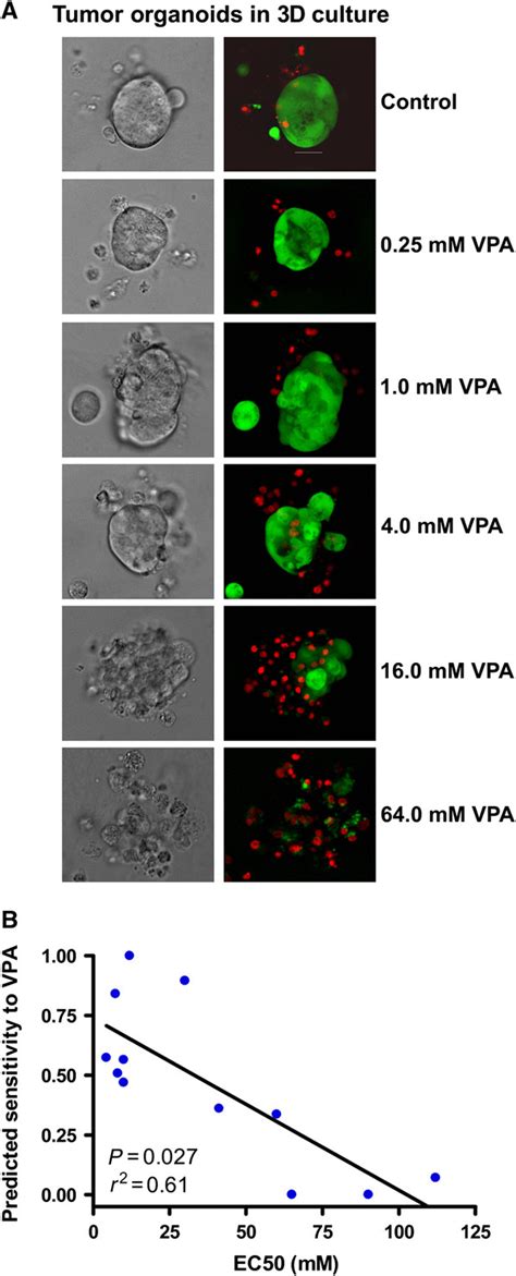Patient Tumor Cell Sensitivity To Vpa In 3d Culture Primary Tumor And