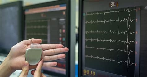 Understanding Pacemaker Checks And Cardiac Monitoring
