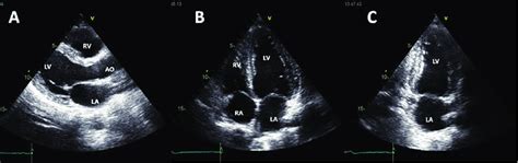 Echocardiographic Views Selected For The Focused Echocardiogram A Download Scientific Diagram