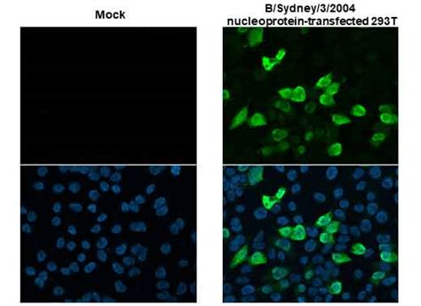 Anti Influenza B Virus Nucleoprotein Antibody Hl1069 Bsa And Azide