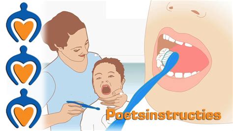 Hoe Vaak Tanden Poetsen Essentiële Tips Voor Mondhygiëne