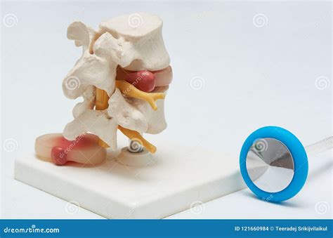 Herniated Lumbar Disc Model And A Stethoscope On White Background Stock