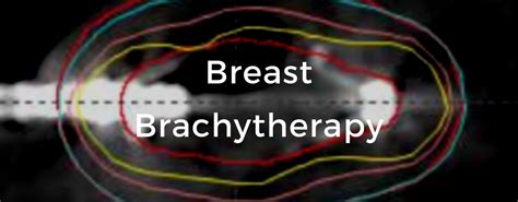 Breast Brachytherapy The Breast Cancer School For Patients