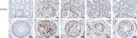 Adsc Exos Promote Spermatogenic Cell Proliferation And Inhibit