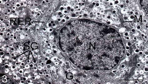 Electron micrograph of ß cell in Langerhans islet of rat pancreas after