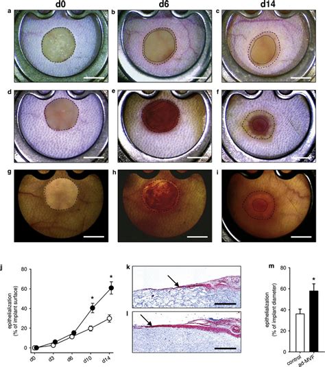 Epithelialization