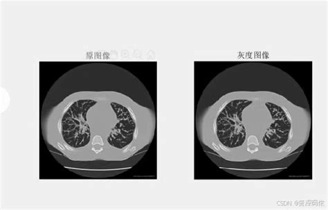 基于matlab分水岭分割算法进行图像分割matlab资深码侬 2048 Ai社区