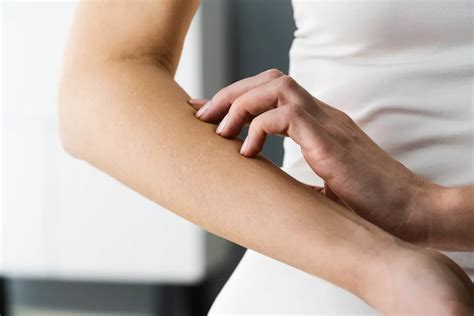 كيف تعرفين أنكِ مصابة بأحد أنواع حساسية الجلد؟ إليكِ 5 طرق جمالك