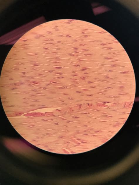 Epithelia And Connective Tissue Diagram Quizlet