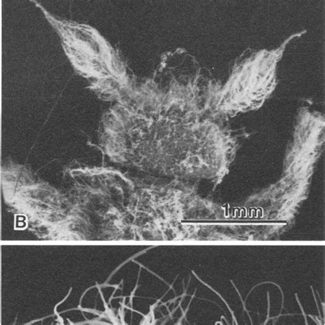 Pdf Occurrence Of A Thiothrix Sp Attached To Mayfly Larvae And