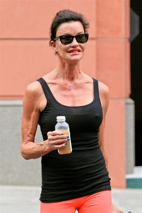 Kako Je Prvi Supermodel Izgledala Pre Operacija Media