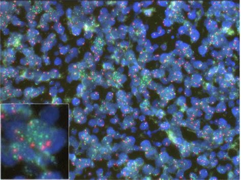 Fluorescent In Situ Hybridization Fish Analysis Of The Programmed