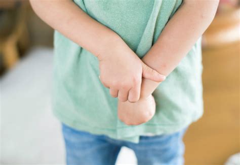 ノースリーブはng 正しいあせも対策でこどものすべすべ肌を守ろう！｜hahacoco ハハココ