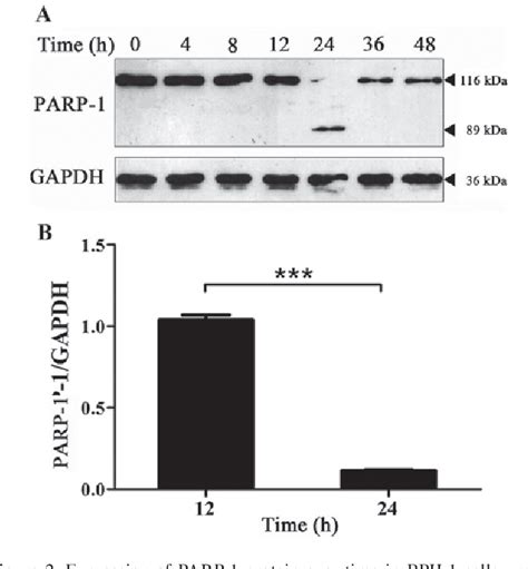 Figure 2 From Crosstalk Between Apoptosis And Autophagy In Prostate