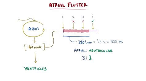 Atrial Flutter Osmosis Youtube