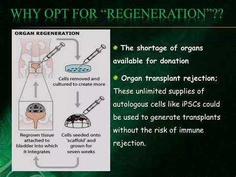 Tissue Engineering And Regenerative Medicine Ppt