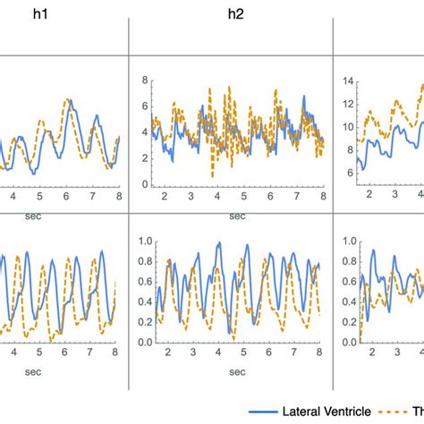 Phase Differences Of CSF Pressure Waveforms Between Lateral And Third Download Scientific