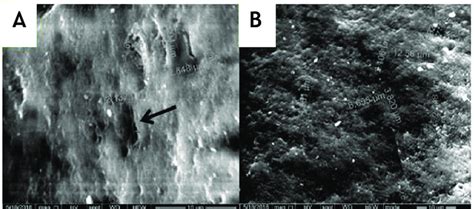 Comparison Between The Microstructure Of The Tooth A With The Download Scientific Diagram