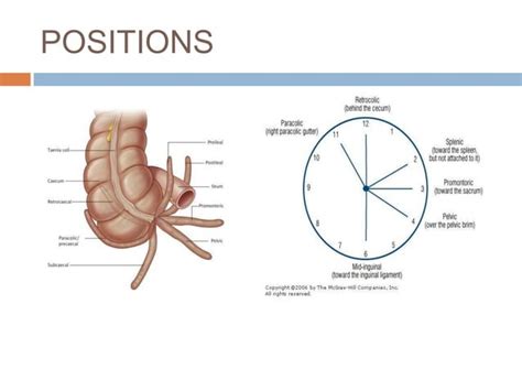 Operative Steps In Open Appendicectomy Pptx