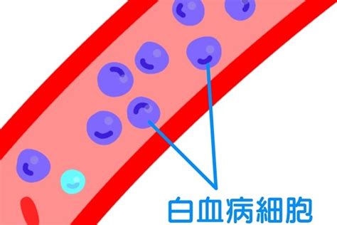 サクッとまるわかり！急性白血病（急性骨髄性白血病、急性リンパ性白血病）の看護診断 なんでなんだナーシング