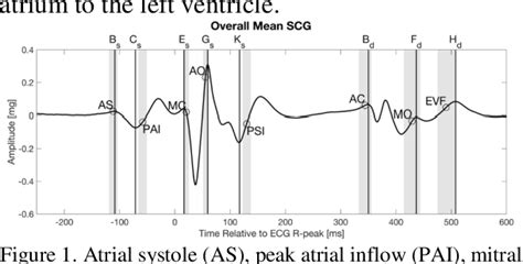 Figure 1 From Comparison Of Seismocardiography Based Heart Rate