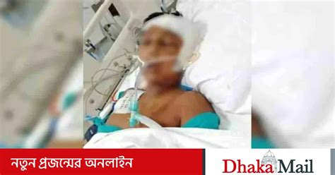 বাঁচানো গেল না আন্দোলনে গুলিবিদ্ধ শিশু রাতুলকে
