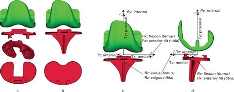 Fluoroscopic And Radiostereometric Analysis Of A Bicruciate Retaining Versus A Posterior