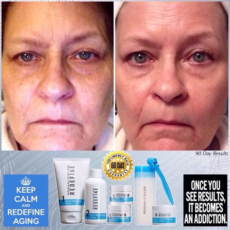 Redefine Regimen With Md Roller Results Rodan And Fields Rodan And Fields Consultant