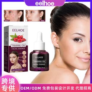 EELHOE 琼崖海棠面油 淡化痘痘痘印闭口细纹补水滋润紧致肌肤精油 阿里巴巴