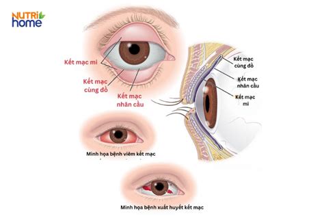 Kết Mạc Là Gì Cấu Tạo Chức Năng Và Các Bệnh Lý Thường Gặp