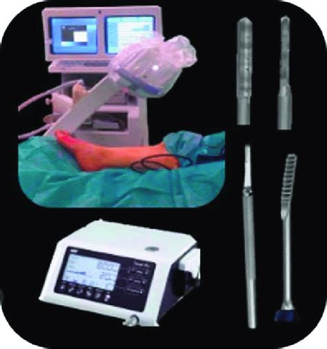 Third Generation Rotational Percutaneous Osteotomy Set Up Download Scientific Diagram
