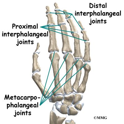 PIP Joint Injuries Of The Finger EOrthopod Com