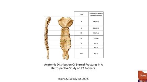 Sternal Fractures And Dislocations Emguidewire Radiology Reading Room